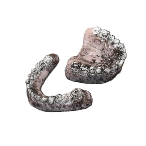 Lower Replacement Teeth (Burn Victim) | 7-S3